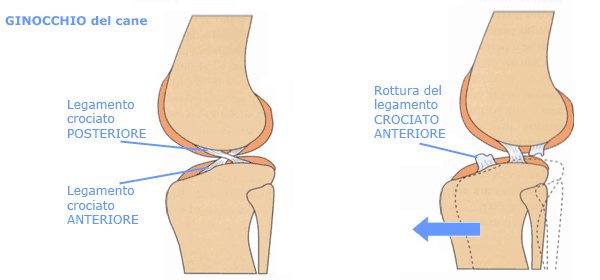Rottura del legamento crociato anteriore. Fisioterapia e consigli ...